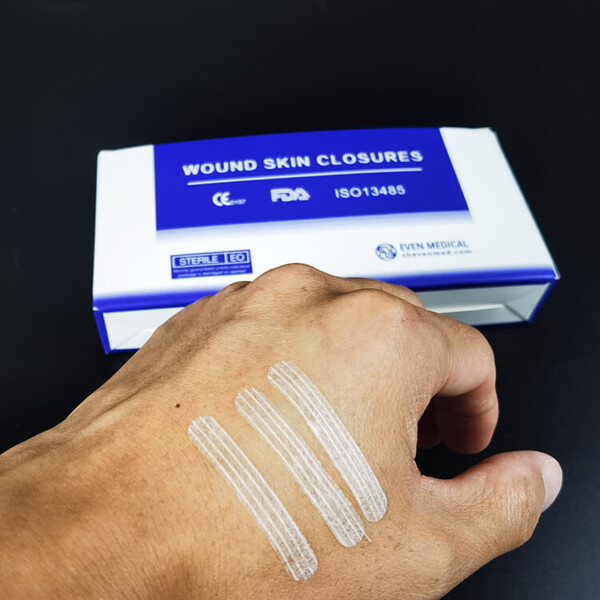 Wound Skin Closure Strip - Evenmed